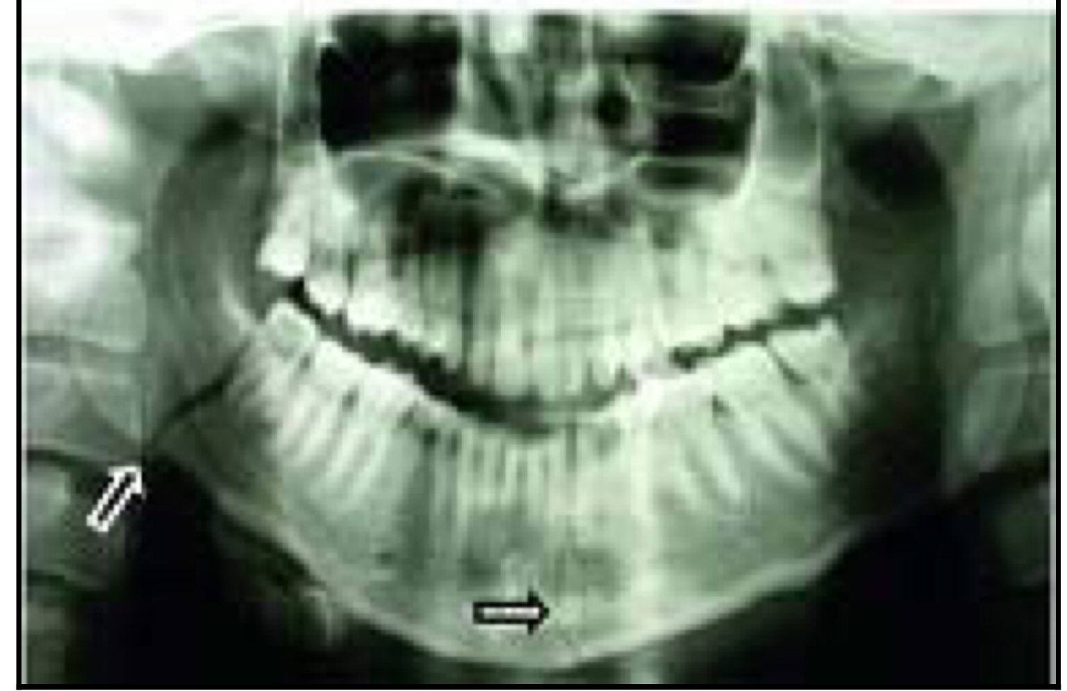 Pathologie-Chir Preparation (Dr. Tuon Vannsathya) – testnisset.com